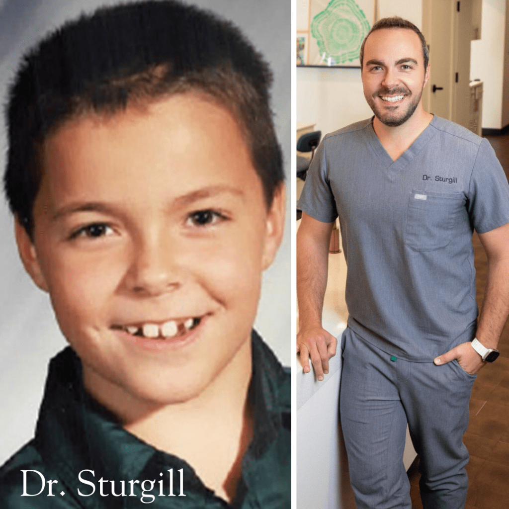 How to Know If You Need Braces in Johnson City